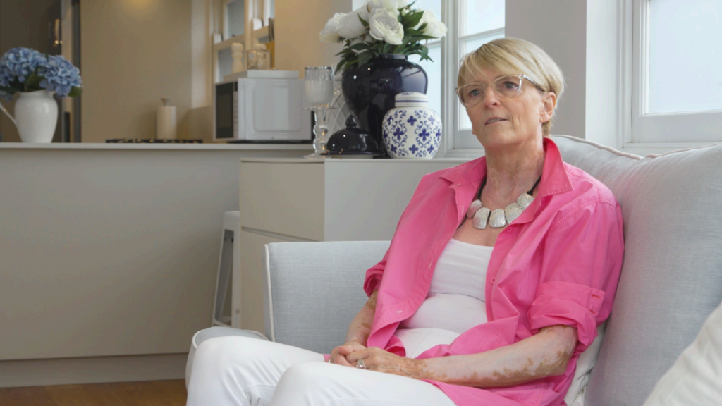 From shame to strength | Anne Gately’s melanoma journey - Conquering Cancer